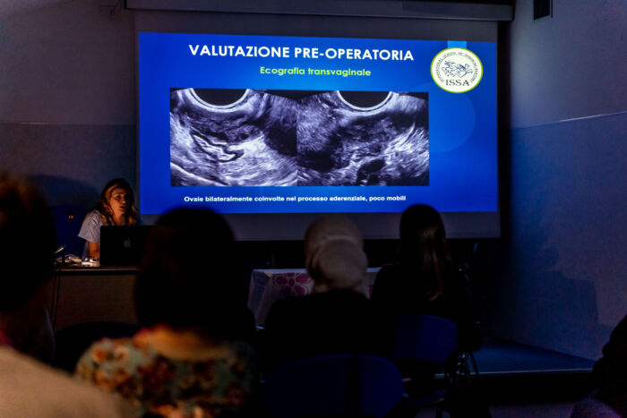 Endometriosi e informazione: meglio parlarne col medico che sui social